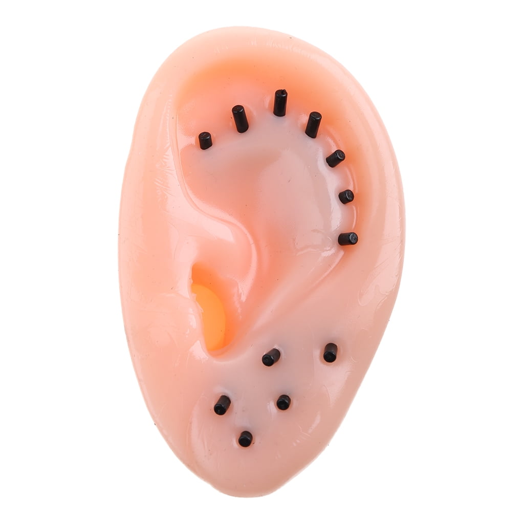 Blackhead Extraction In Ear