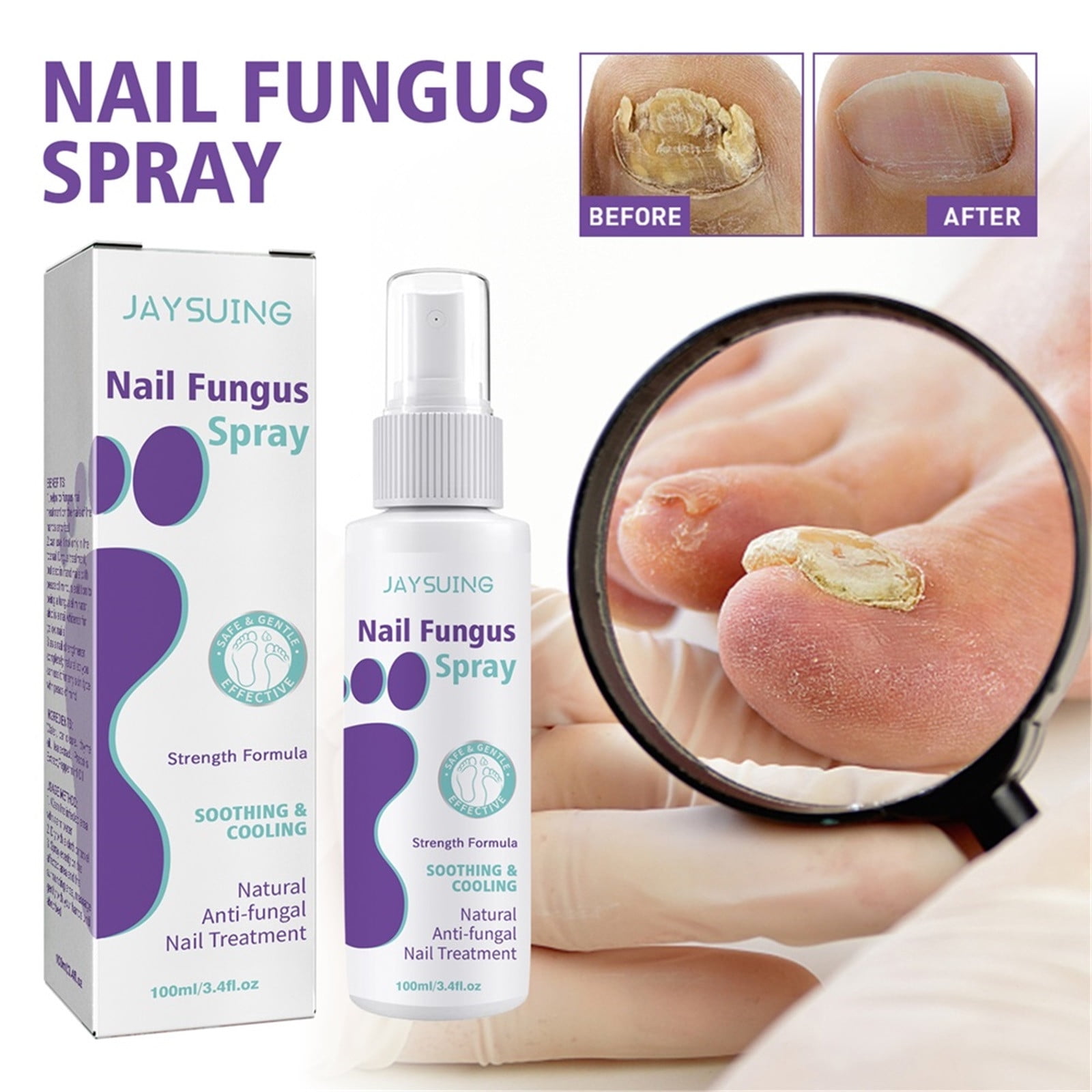 Click here for Beauty Brags Fungus Spray  Advanced Foot And Nail... prices