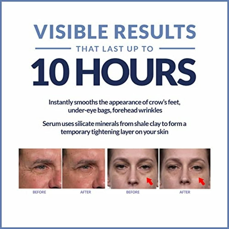 Plexaderm Rapid Reduction Serum | ppgbbe.intranet.biologia.ufrj.br