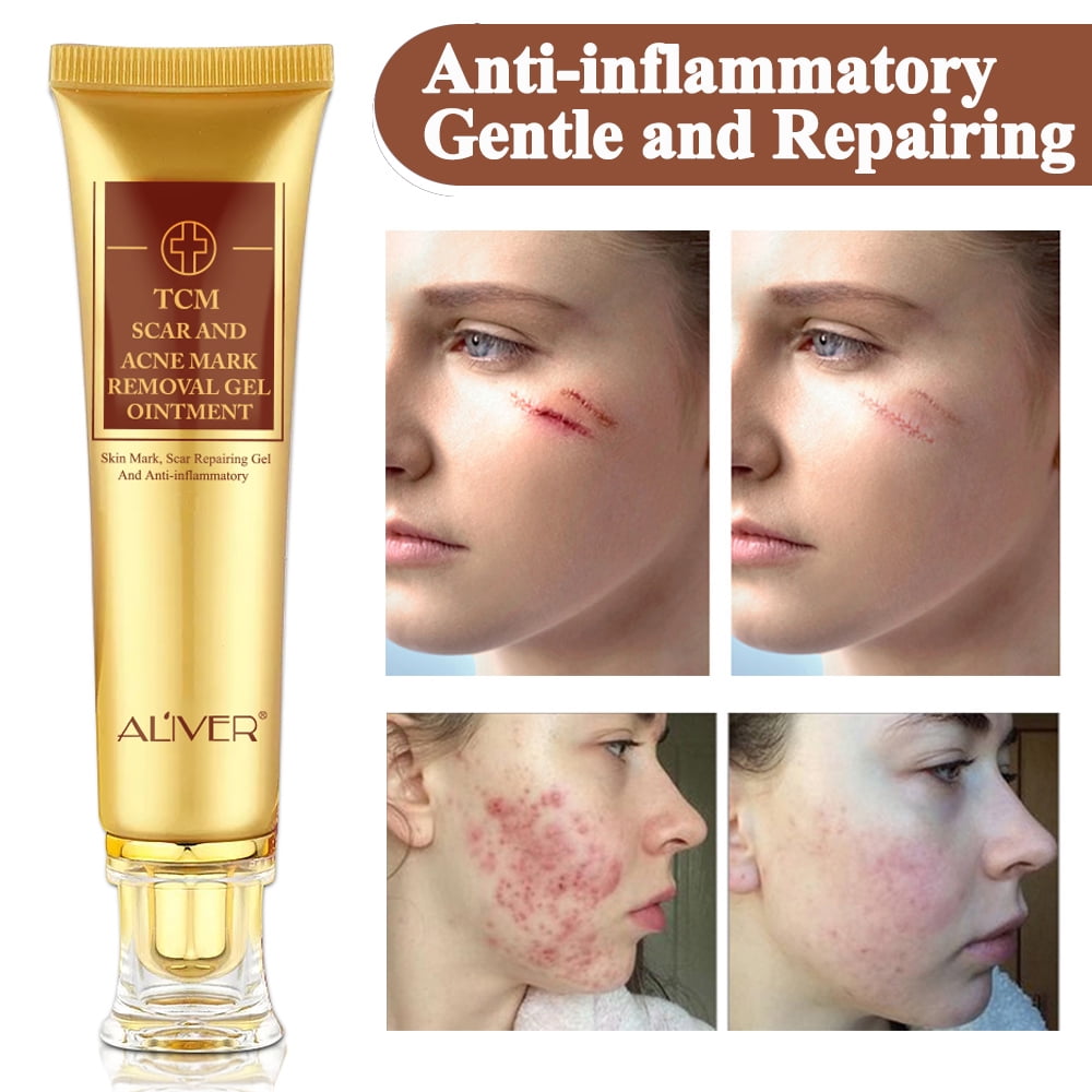 Aliver TCM Scar Acne Mark Removal Gel Anti-inflammatory Scar Treatment ...