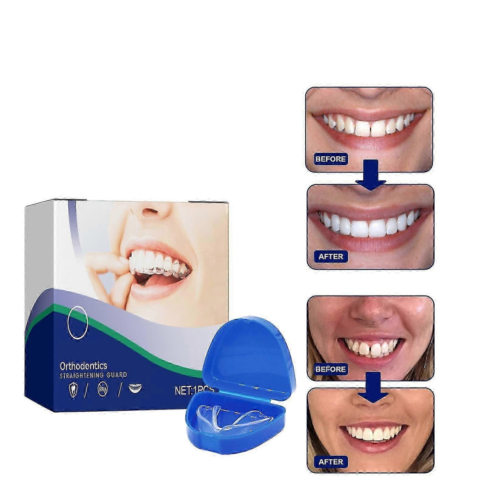 Mouth Guard for Clenching Teeth at Night, Moldable Mouth Guard for ...