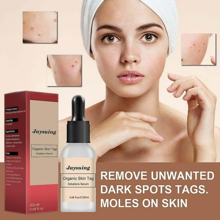 NETSENG Organic Skin Tag Solution Serum Mole Essential Oil 20ml ...