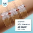 (6 CT) Zip Stitch Wound Closure Kit - Scar-Free Healing Butterfly ...