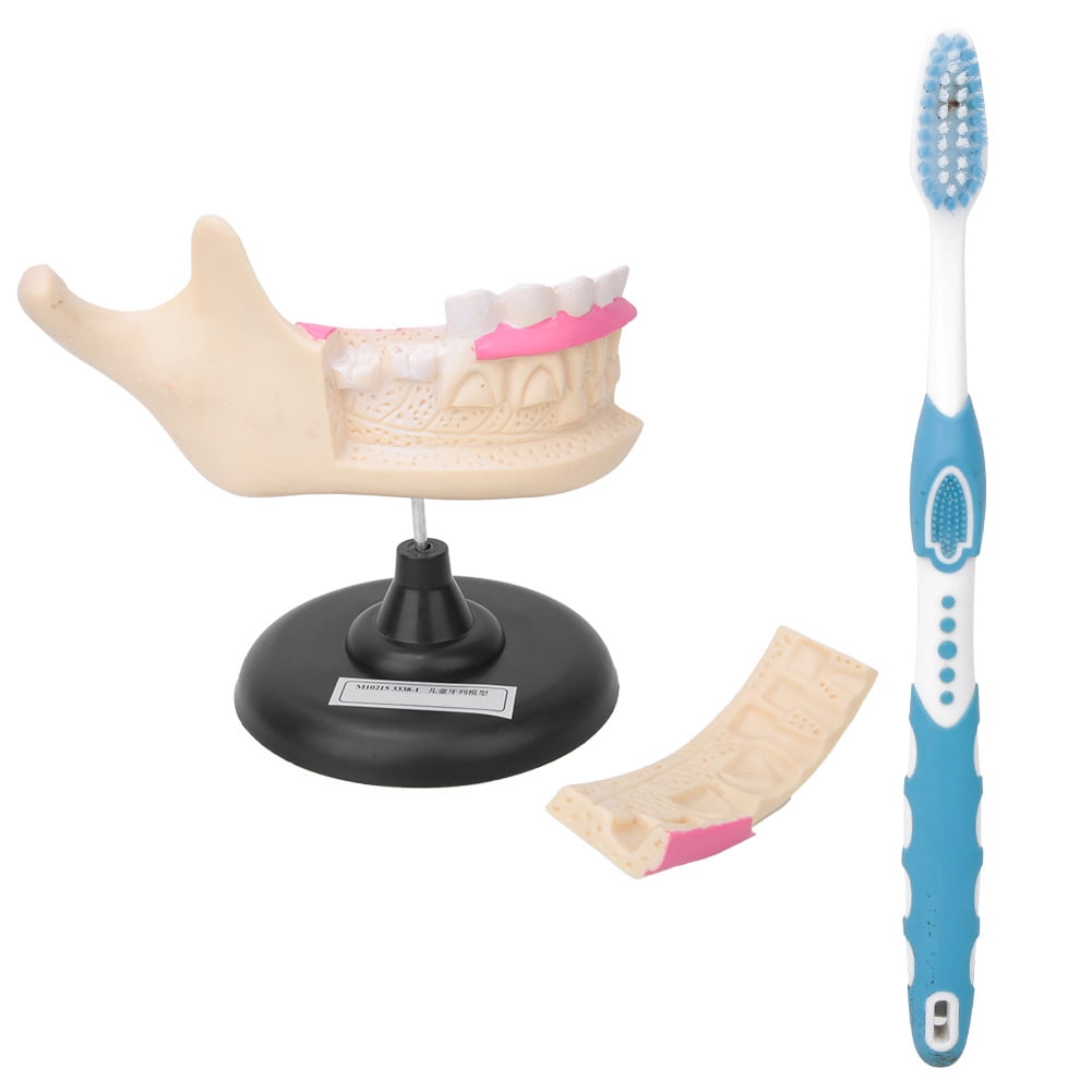 Raíz Caries Dientes Dientes Enfermedad Dental Anatómico Biológico ...
