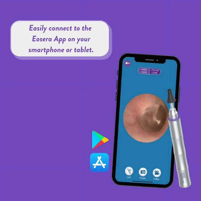 Otoscope View