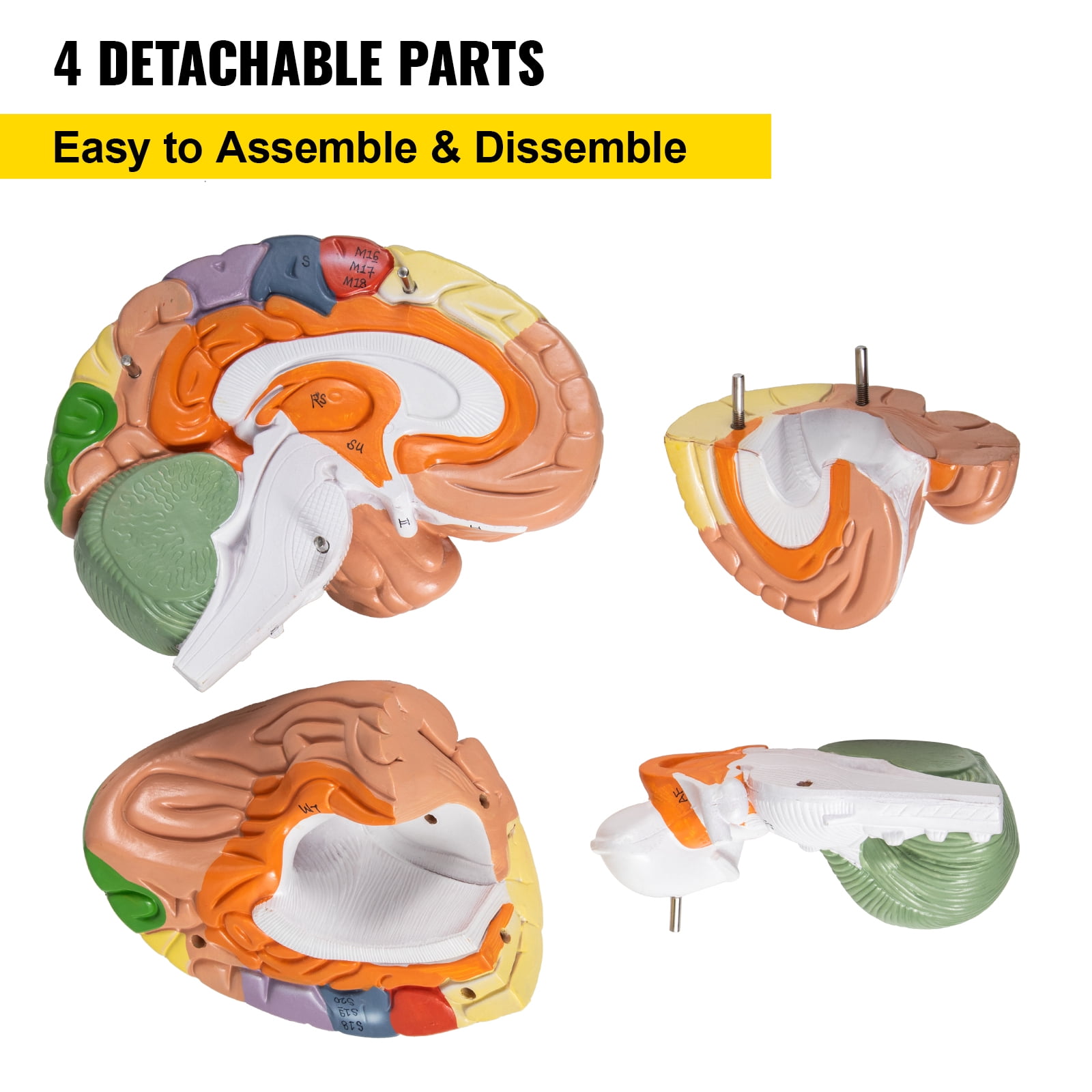 Midsagittal Section Of The Brain Color Coded