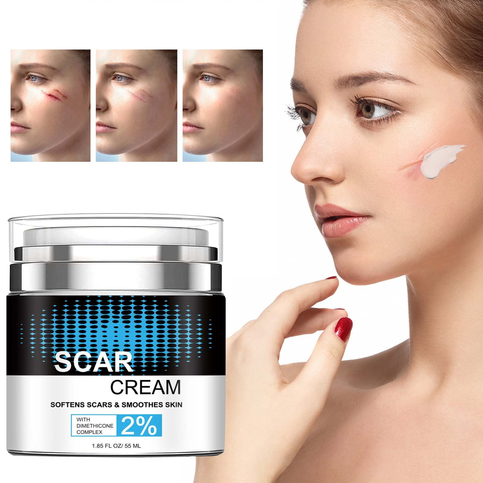 Scar Nourishing Deeply Moisturizing Reduces Scar Visibility Natural ...