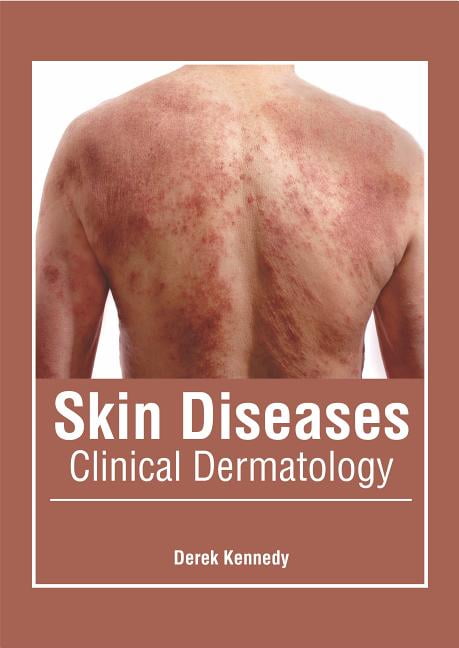 Skin Diseases: Clinical Dermatology (Hardcover) - Walmart.com - Walmart.com