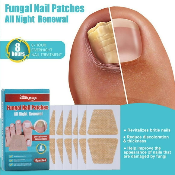 Outgrow Toenail