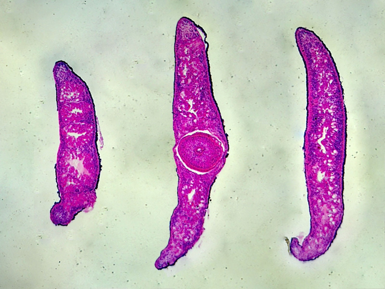Planaria Under Microscope