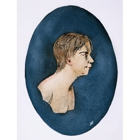 Wild Boy Of Aveyron /N(C1788-1828). Also Known As Victor Of Aveyron ...
