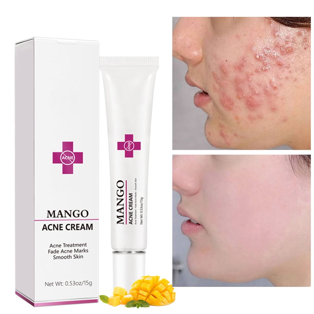 Crema anti-cicatrices de acné para poros limpios y cerrados y un brillo ...
