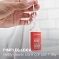 Neutrogena Stubborn Acne Spot Drying Treatment, 10% Sulfur, Overnight ...