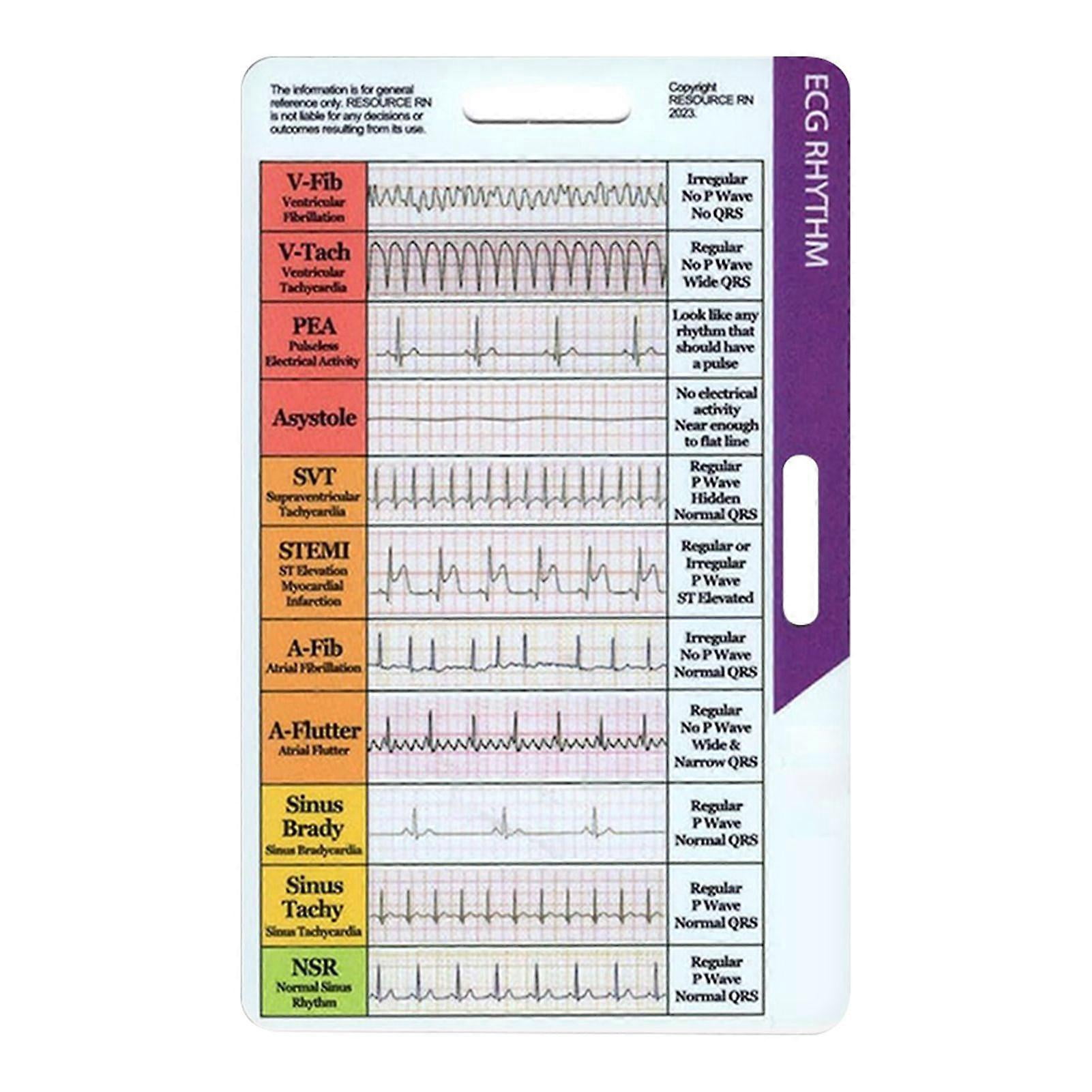 ECG/EKG Rhythms Pocket Card, Double-Sided Interpretation Guide for ...