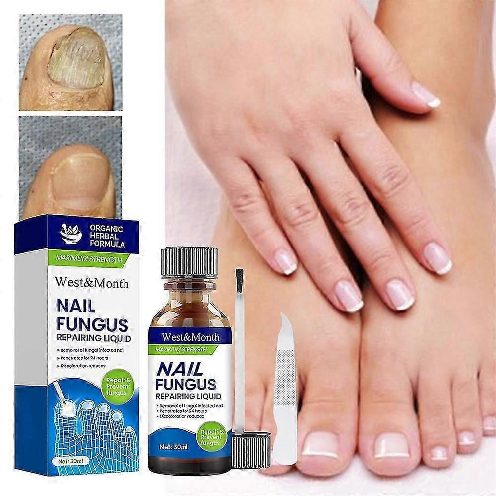 Tratamiento para hongos en las uñas de los pies, kit de 30 ml para ...
