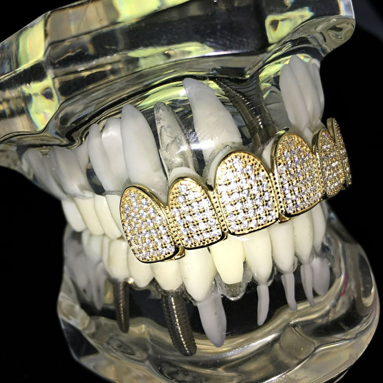 Silver Fronts Teeth