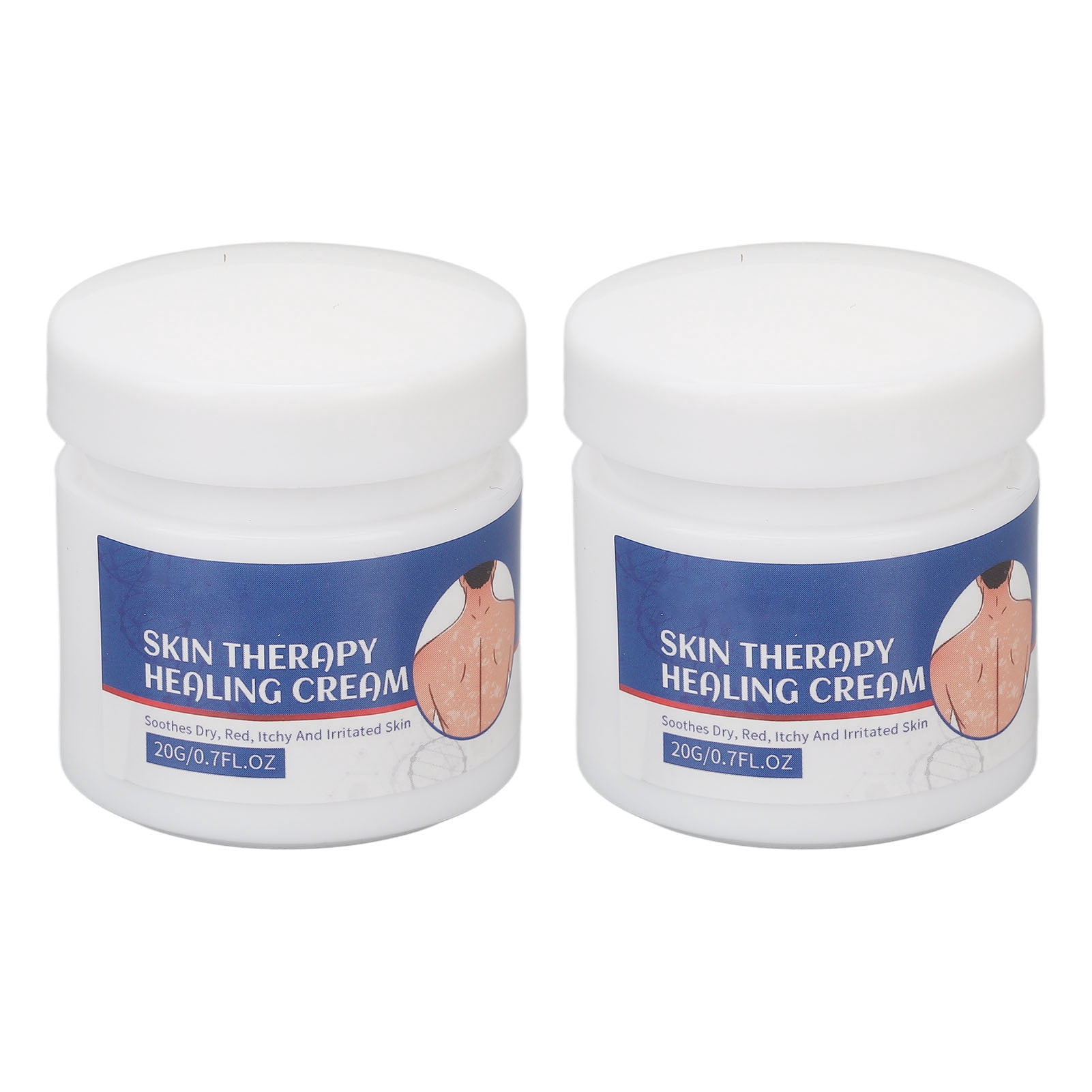 Crema Para El Tratamiento De La Picazón En La Piel, Crema Para El ...