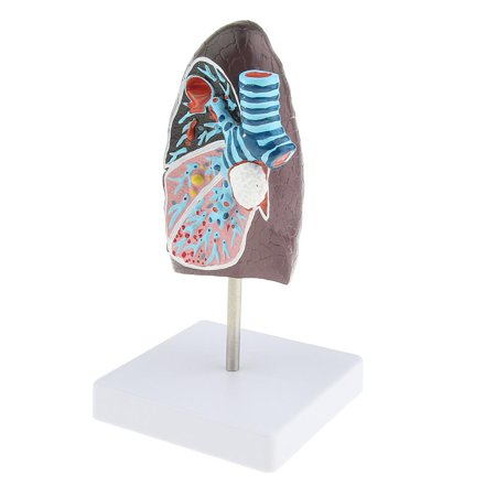 Diseased Lung Model Pulmonary Respiratory System | Walmart Canada