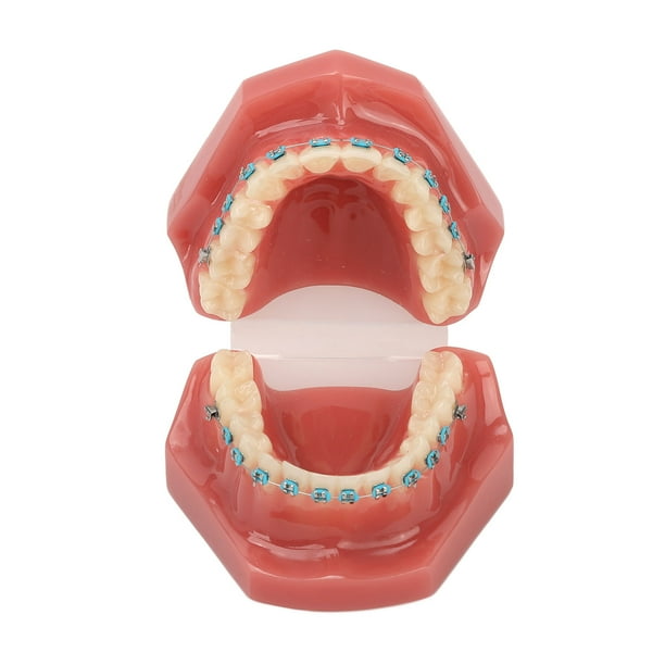 Orthodontics Model, Orthodontic Tooth Model Clear Structure For Better ...