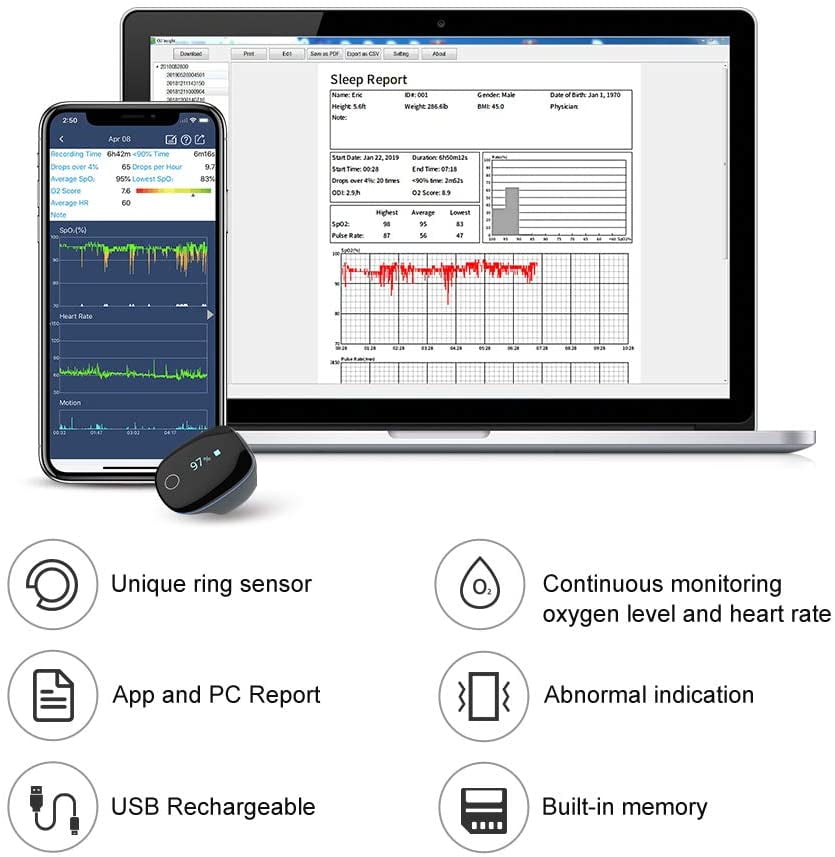 Professional sleep monitor - rodenjl