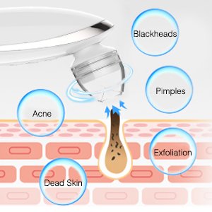 Blackhead Removal Diagram