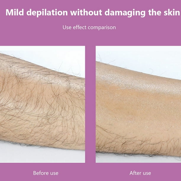 TB&W Physical Hair Removal Painless Home Epilator Cleaning Depilation ...