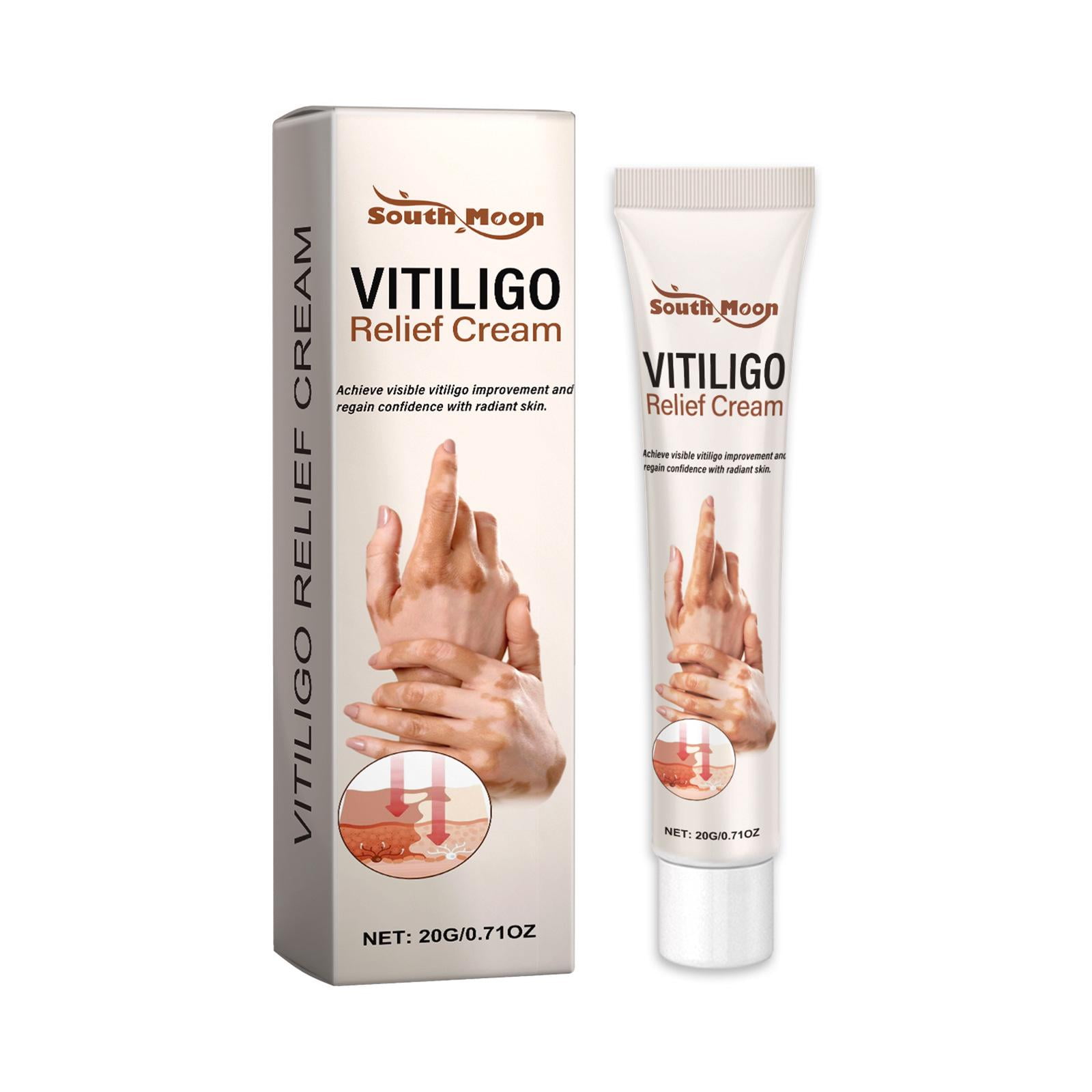 Crema para el tratamiento del vitíligo, tratamiento natural para el ...