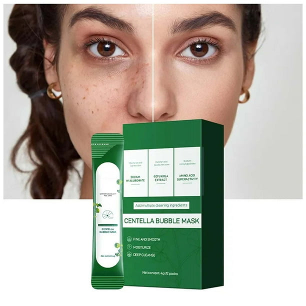 Fiudx Mascarilla Facial de Burbujas, Tratamiento Hidratante de Limpieza Profunda, Eliminador ...