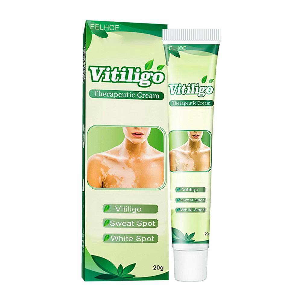 20g Psoriasis ungüento localizado piel tópica marcas cuidado cremas ...
