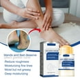 TYTSPEASY Salicylic Foot Moisturizer For Dry Feet Knees Elbows Hands ...