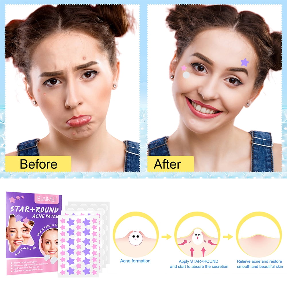 Parche Para Espinillas Para Eliminar El Acné 126 Parches Invisibles ...