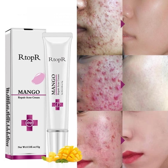 Cyst Removal Cream