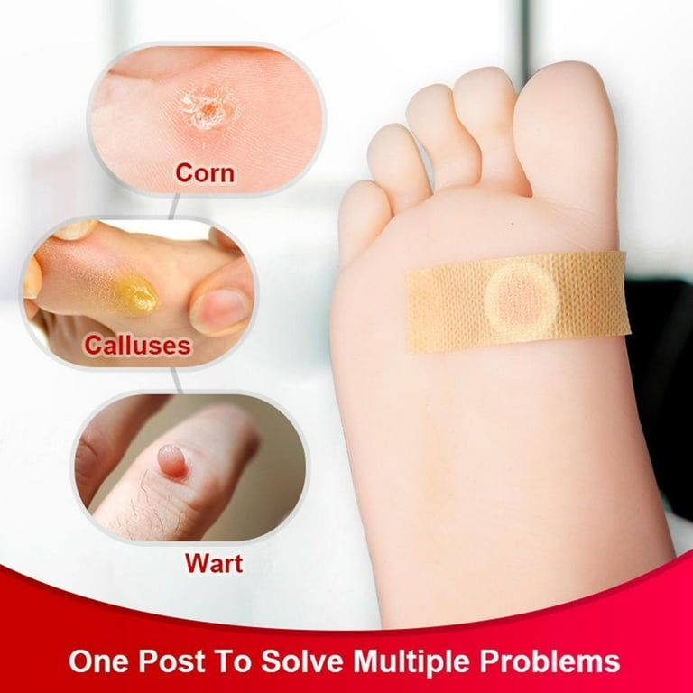 Plantar Wart Removal Hole