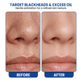 Madnice Volcanic Clay Mask (6ct) – Powder Formula to Reduce Oil & Treat ...
