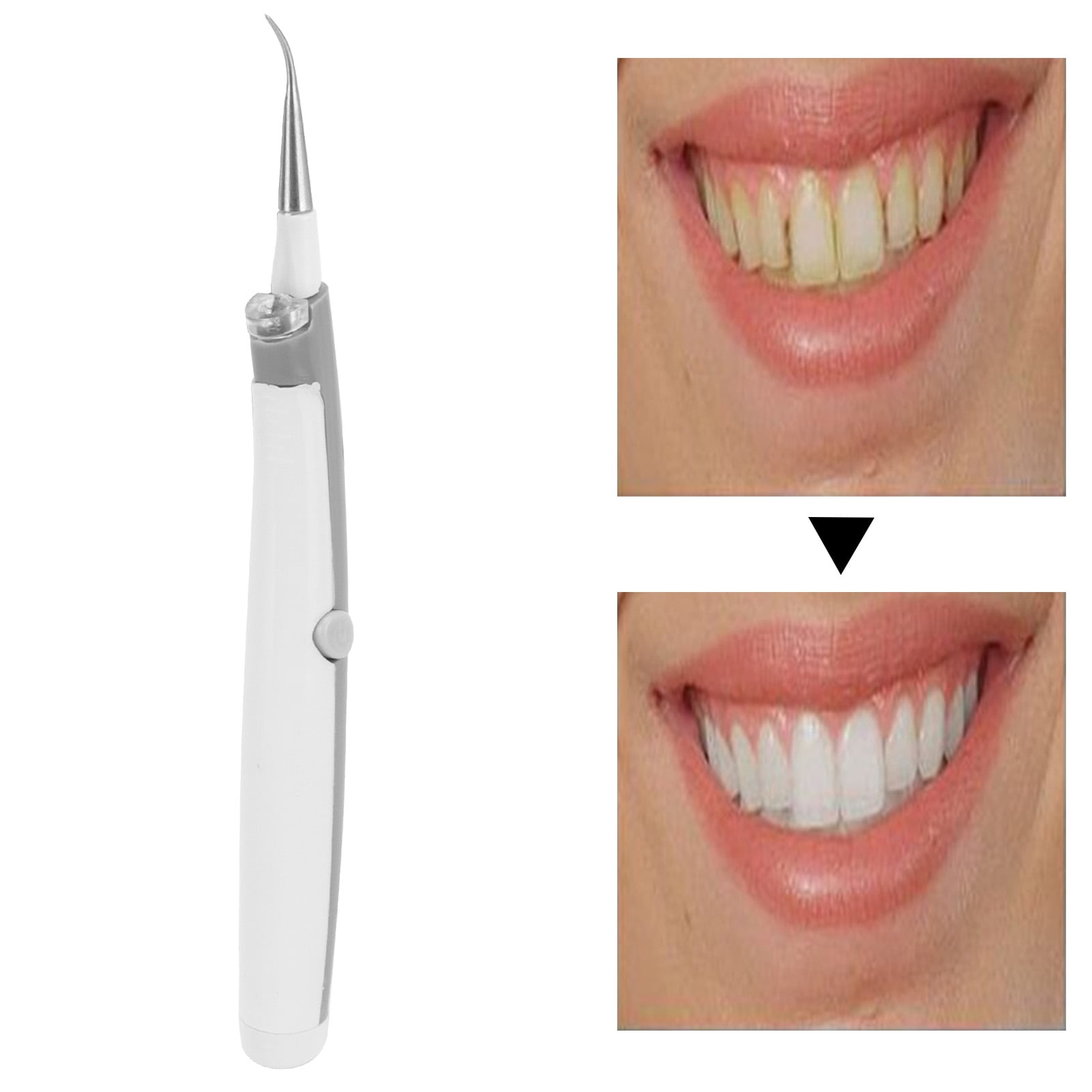 Click here for Hilitand Tooth Cleaner tooth Cleaner Electric Port... prices