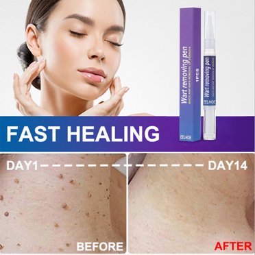 50 Wart and Fungus Removing and Preventing Meal Recipes : Quickly and ...