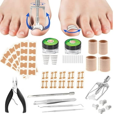 Ingrown Toenail Pain Reliever, 1 kit, (w/ Gel, 12 retainer rings & 12 ...