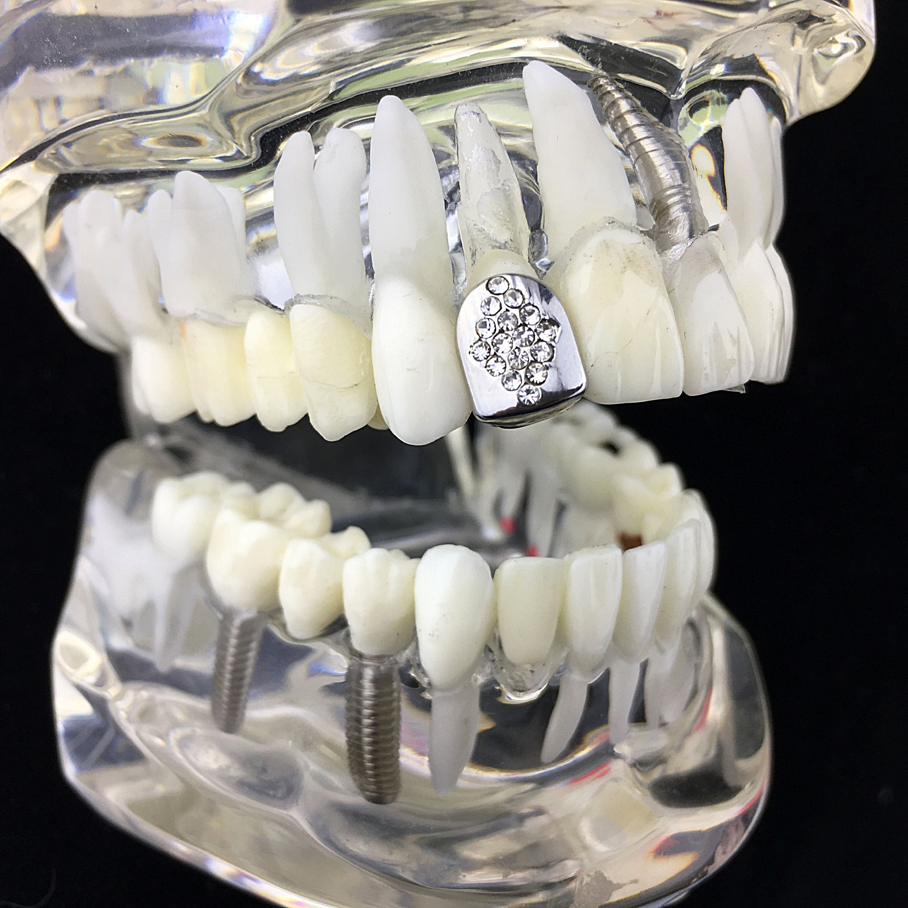 Single Cap Grill Diamond-Shape Silver Tone One Tooth Philippines | Ubuy