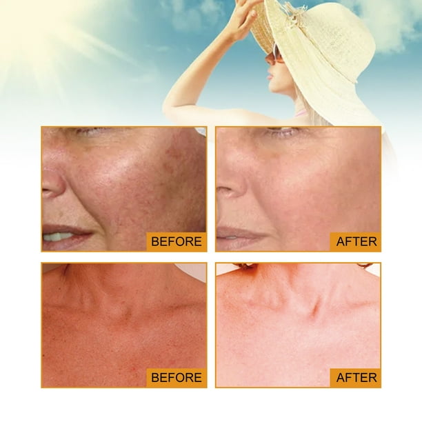 Eucerin Protector solar facial efecto mate toque seco Oil Control, , 50 ...