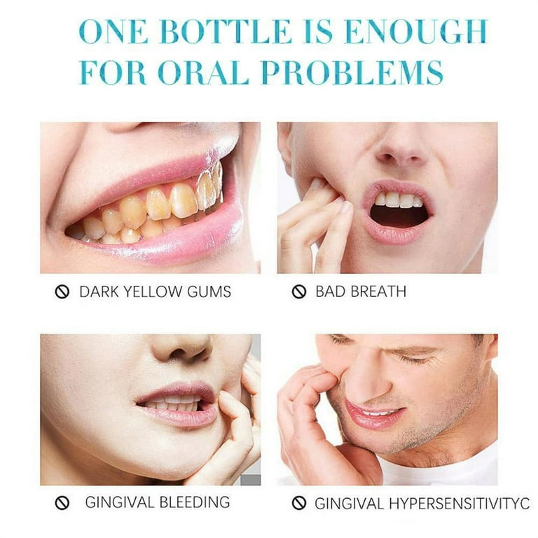 Hydrogen Peroxide Baking Soda Teeth Whitening Before After