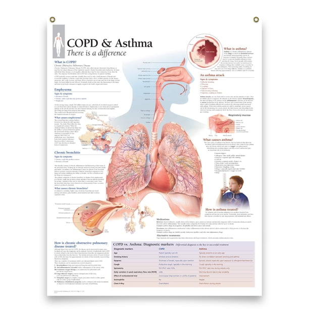 COPD and Asthma Laminated Medical Educational Informational Poster ...