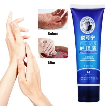 80G Hand Foot Crack Prevention Cream Moisturizing Prevention Cream Anti ...