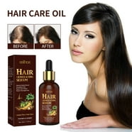 PERFECX Scalp Healing Ayurvedic Hair Oil 2oz (1PCE) - Walmart.com