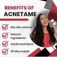 Acnetame, Skin Supplements for Oily Skin, Hormonal Acne, Blemish ...
