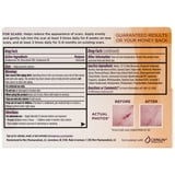 Mederma, Scar Cream, SPF 30, 0.7 oz, with Cepalin Botanical Extract ...