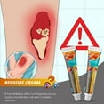 Ultra Strong Bedsore Creamulcer Cream , Moisturize Decubitus,remove Rots Myogenic Pressure