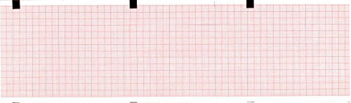 ECG Paper 80MM X 90MM X 360Sheet (Works for HELLIGE Contrast, MAC 400 ...