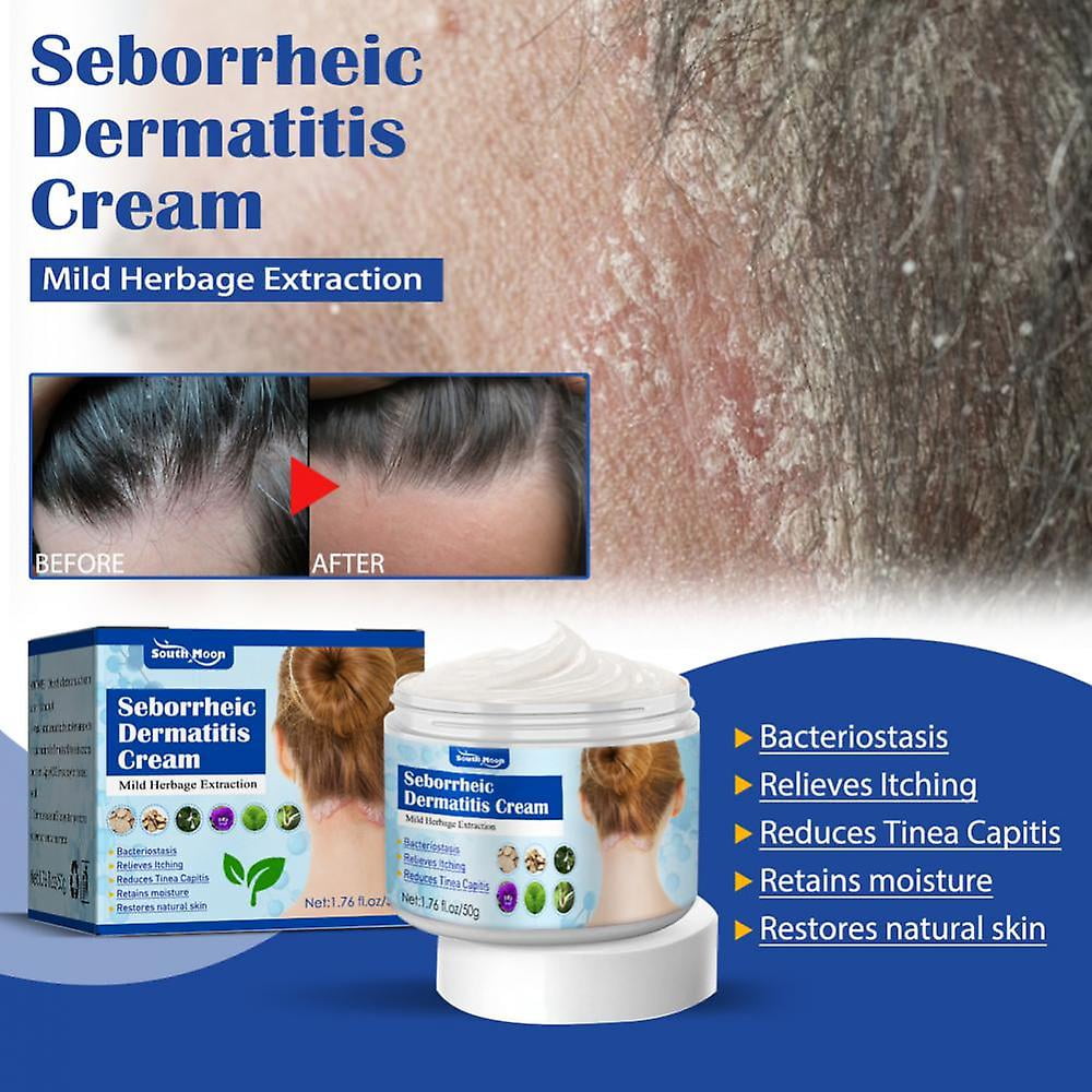Seborrheic Skin Cream Head Acne Pruritus Scalp Ringworm Skin Problem ...
