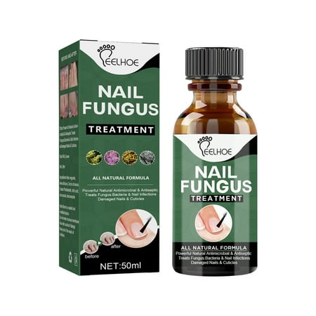 EELHOE 50ml Nail Fungus Treatment Solution Herbal Extracts Remove ...