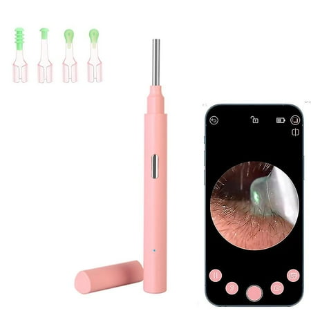 Wireless Smart Visual Ear Cleaner Otoscope Ear Wax Removal Tool ...
